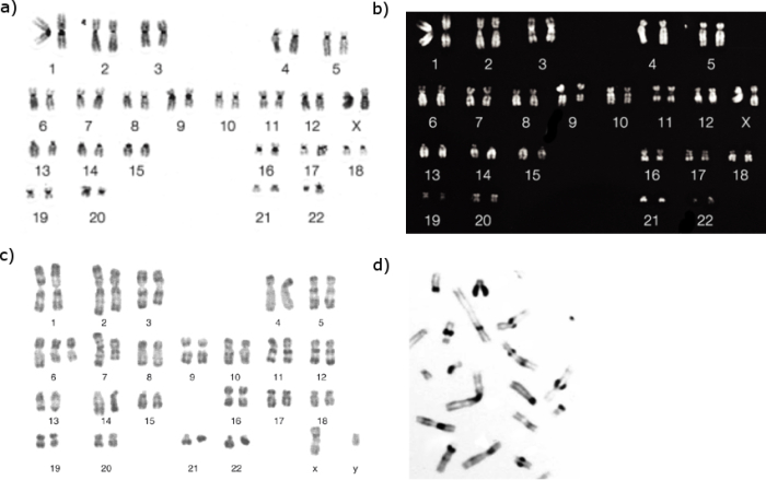 CHROMOSOME(KARYOTYPE) ANALYSIS – Krown Laboratory and Referral Center